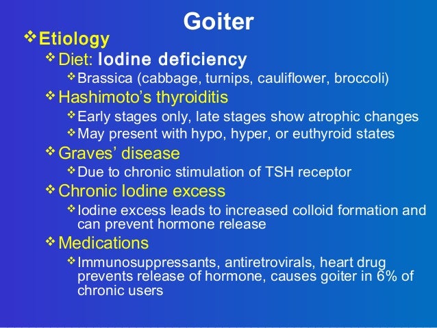 Goiter