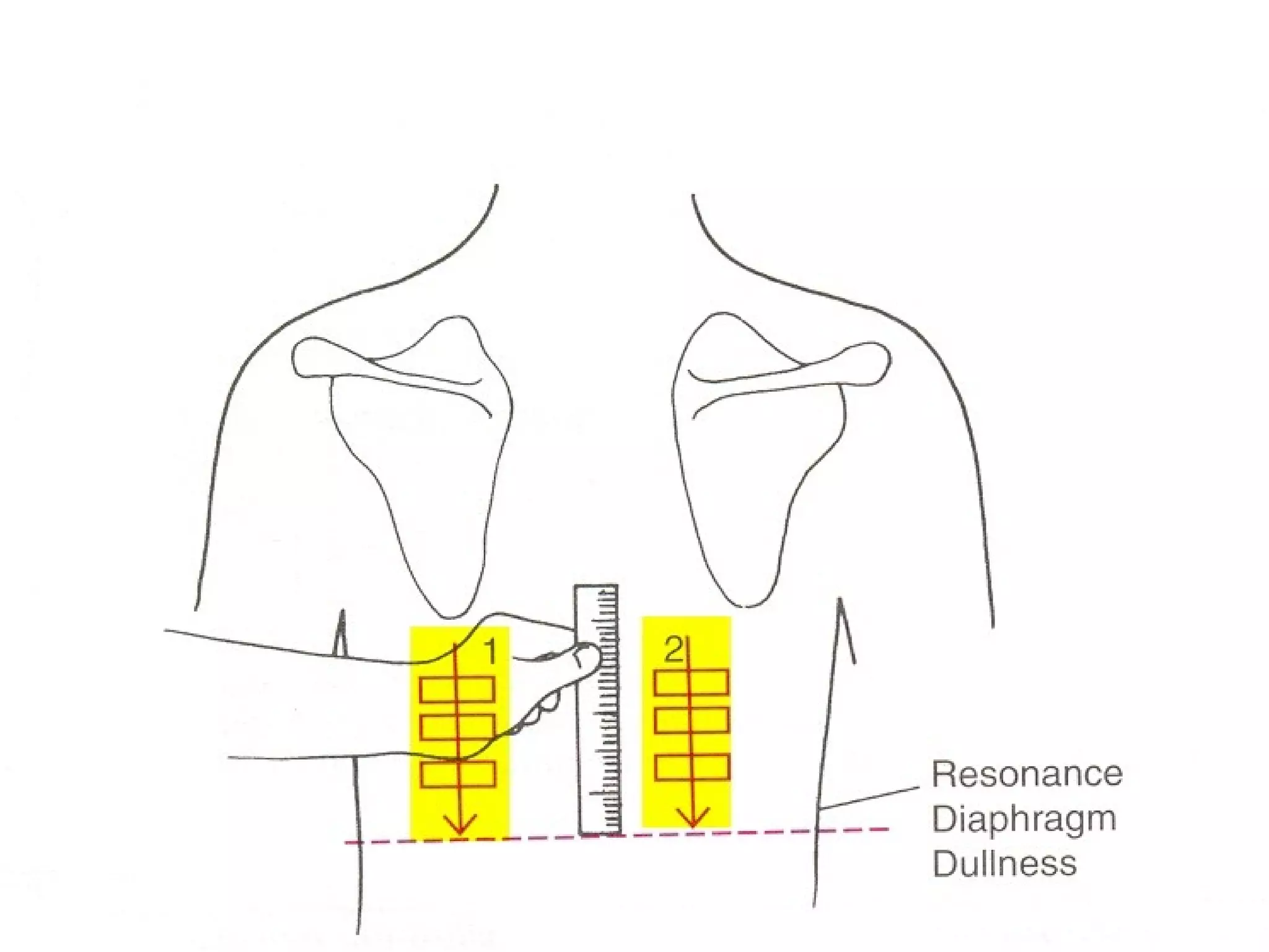 thoracic & lung assessment | PPT
