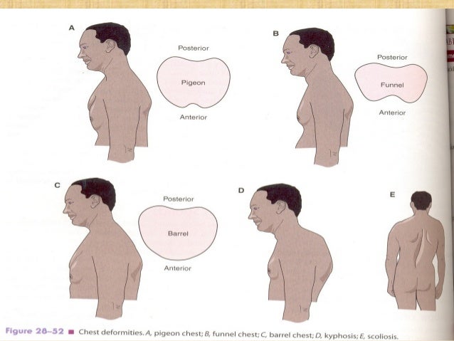 thoracic & lung assessment