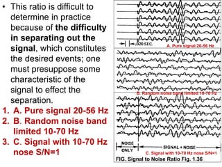 Lect 10 Signal noice-1.pptx
