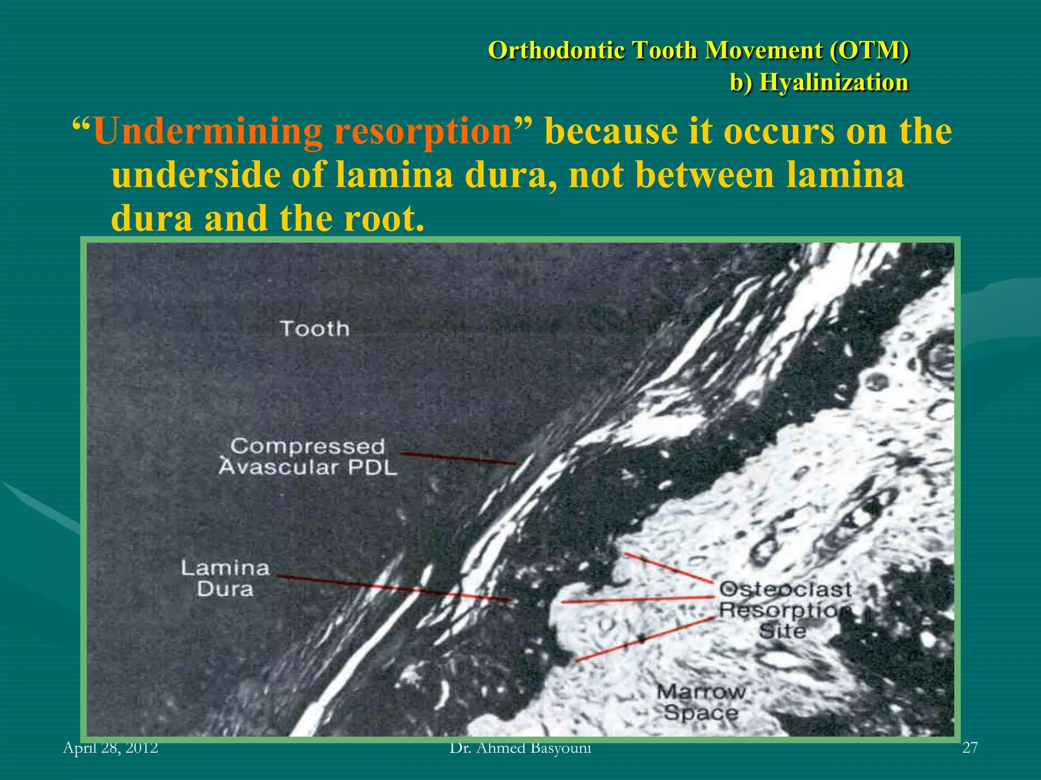 Biology of Tooth Movement | PDF