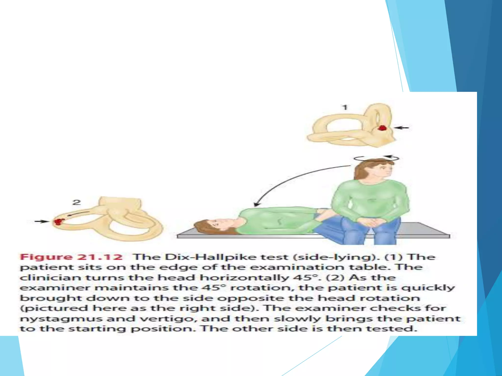 lect 15 Vestibular Rehabilitation.pptx