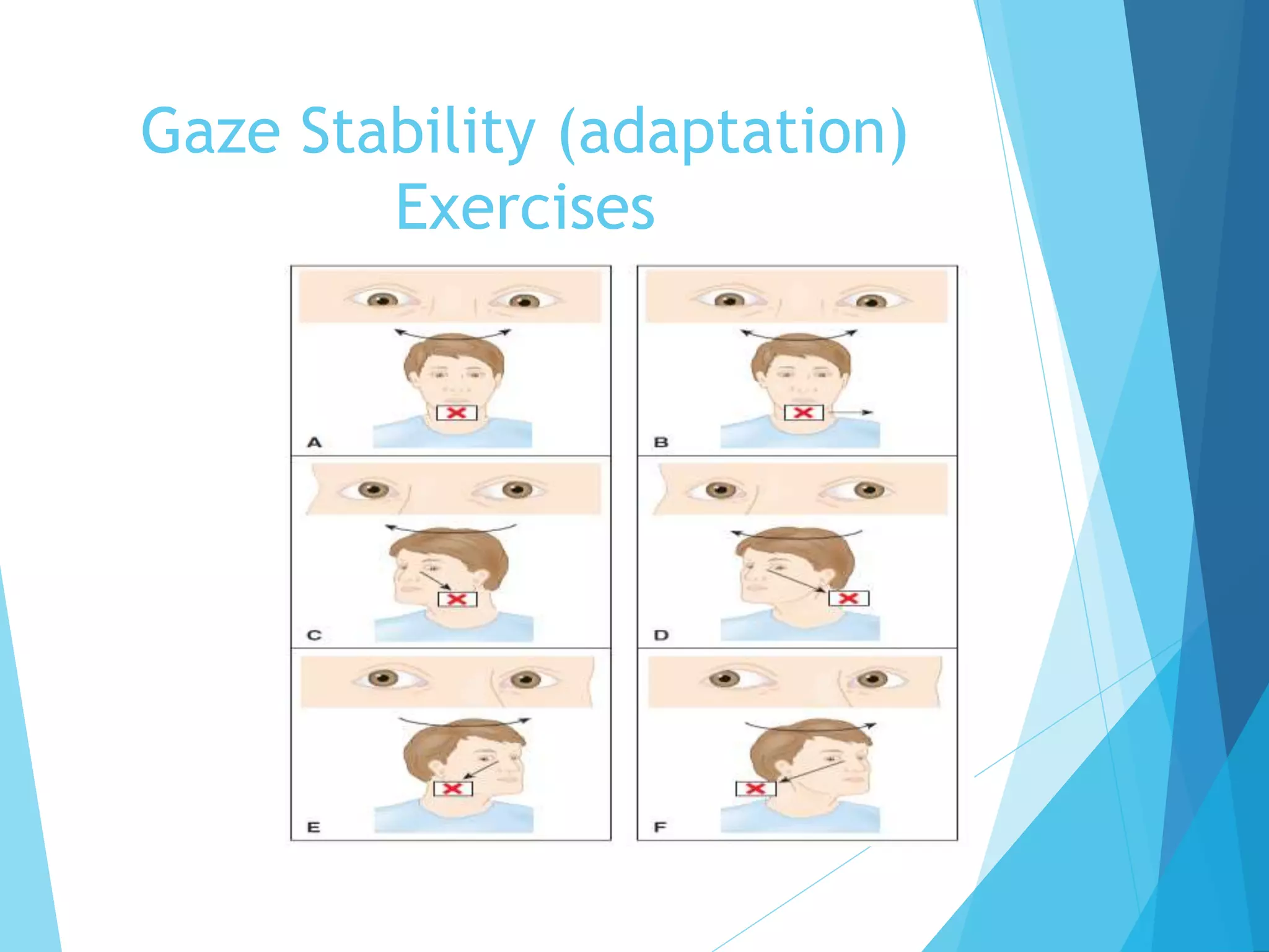 lect 15 Vestibular Rehabilitation.pptx