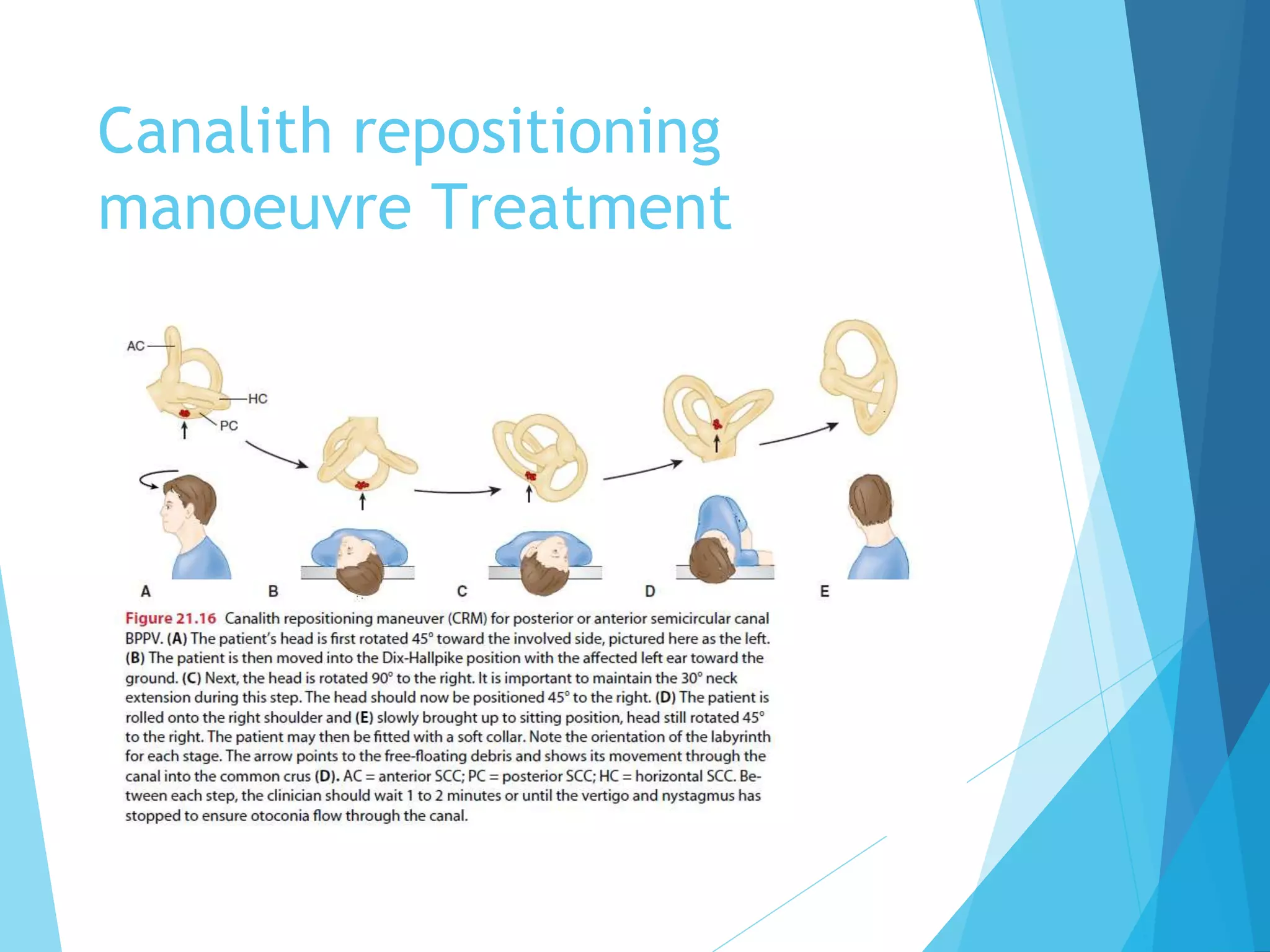 lect 15 Vestibular Rehabilitation.pptx