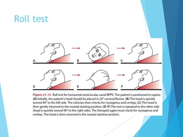 lect 15 Vestibular Rehabilitation.pptx