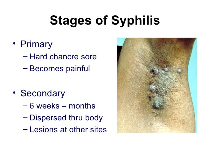 Lect 16 Viruses and Bacteria