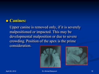 Therapeutic Extraction | PDF