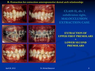 Therapeutic Extraction | PDF