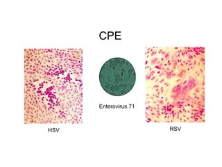 Lect 2 laboratory diagnosis of viral infections | PPT | Infectious ...