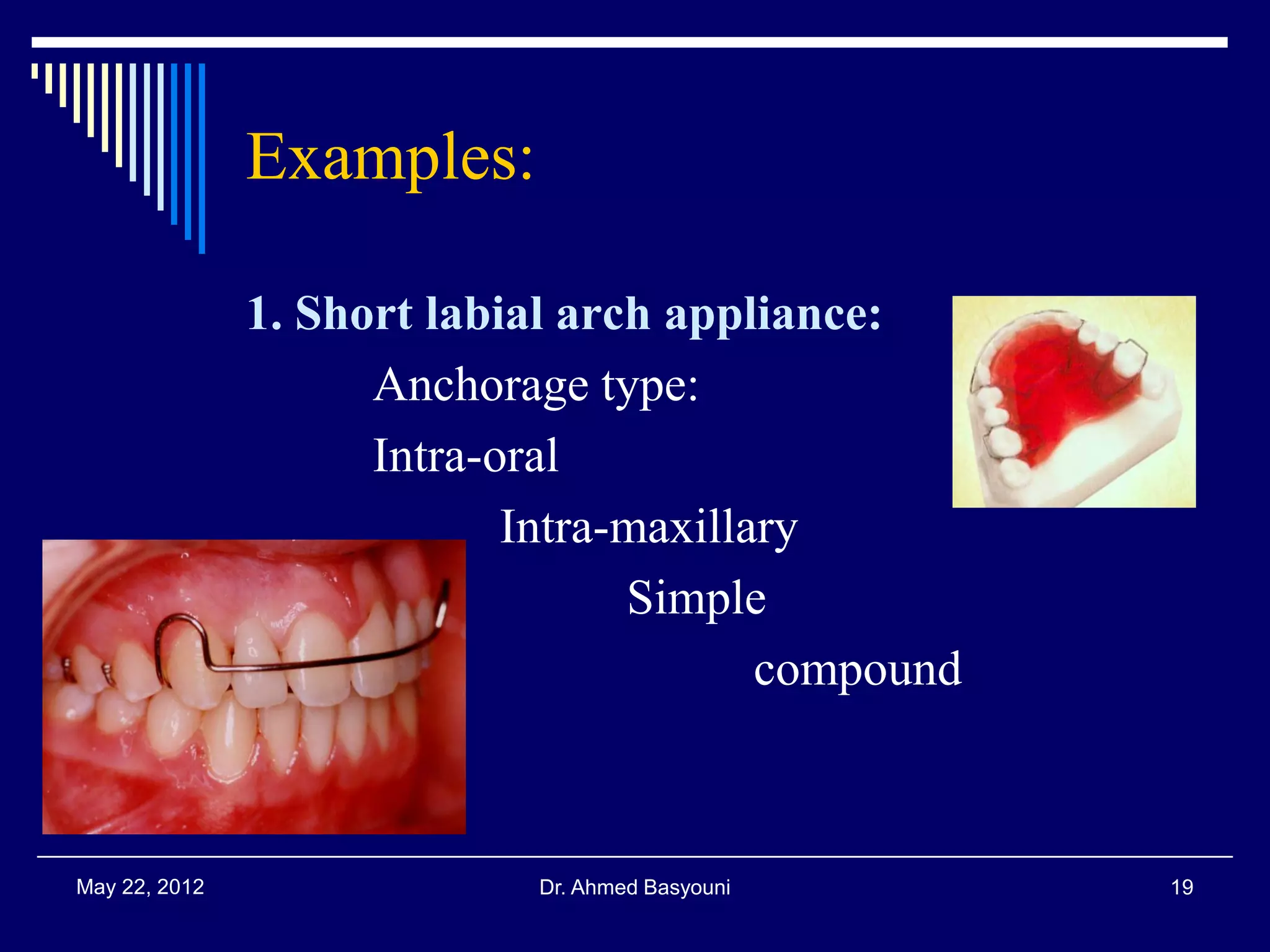 Anchorage in Orthodontics | PDF