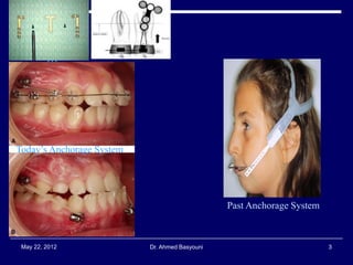 Anchorage in Orthodontics | PDF