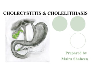 Lect 28 Cholecystitis-Cholelithiasis.ppt
