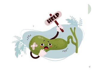 Lect 28 Cholecystitis-Cholelithiasis.ppt