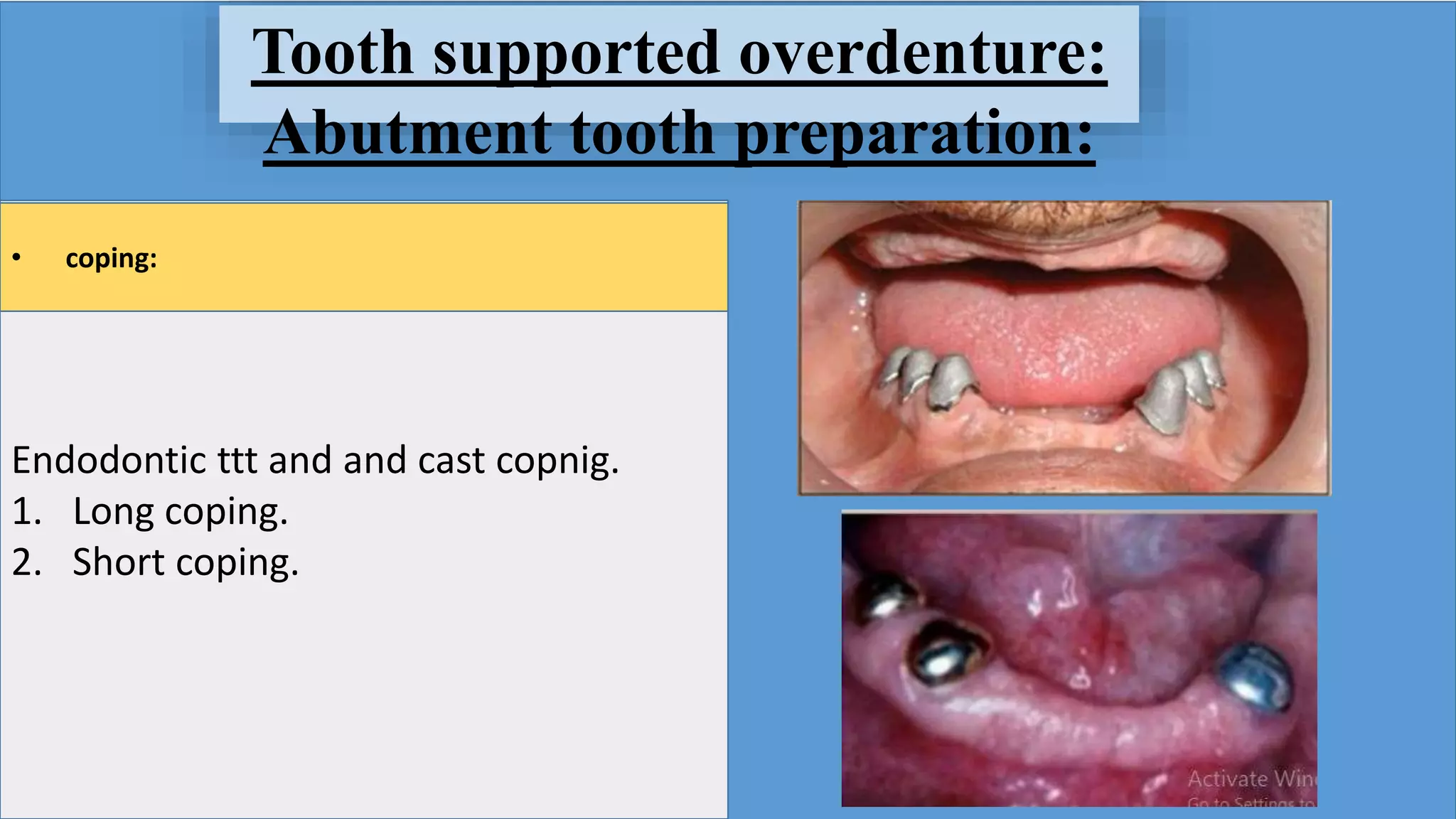 lect2 overdenture level 3.pptx