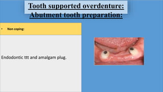 lect2 overdenture level 3.pptx