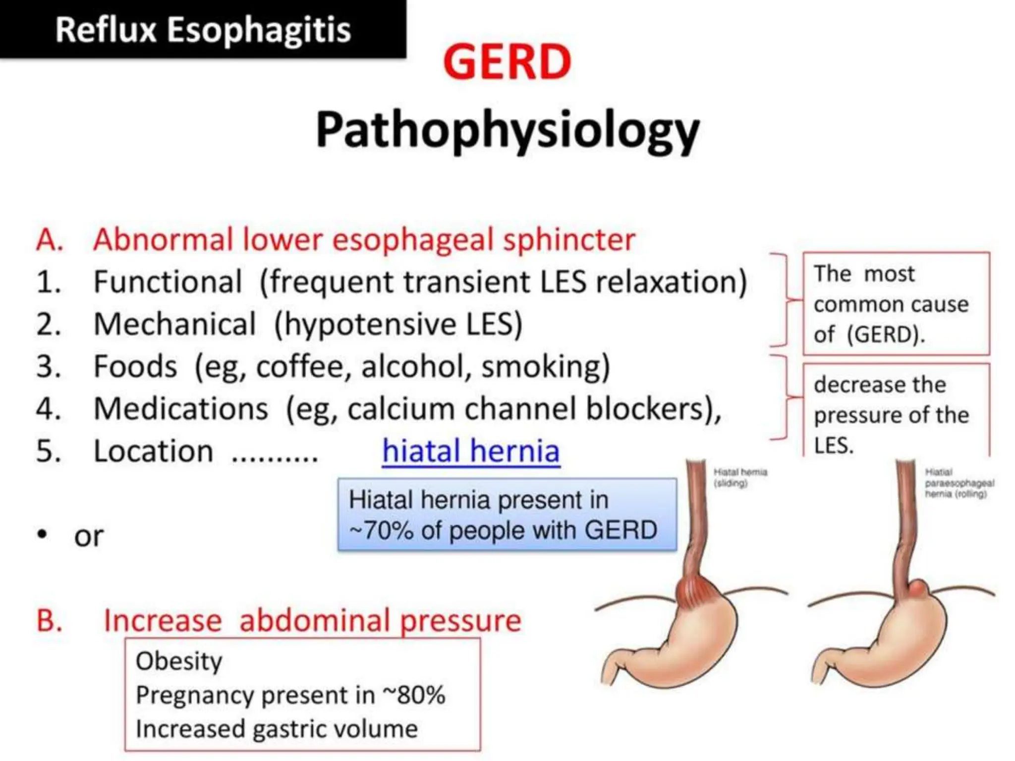 Lecture no. 3. GERD.pptx Adult Health Gastro intestinal | PPT