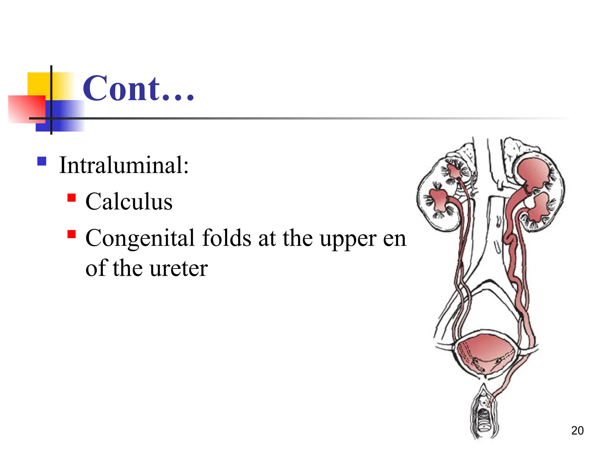 lec urethral strictures & hydronephrosis | PPT