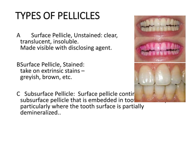 LECT 3 DENTAL PLAQUE DEFINITION AND AETIOLOGY .pptx