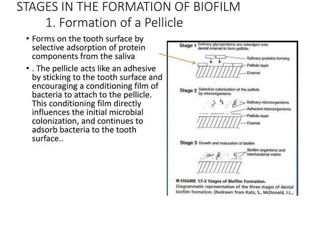 LECT 3 DENTAL PLAQUE DEFINITION AND AETIOLOGY .pptx