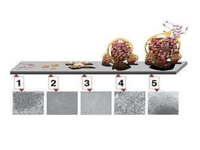 LECT 3 DENTAL PLAQUE DEFINITION AND AETIOLOGY .pptx