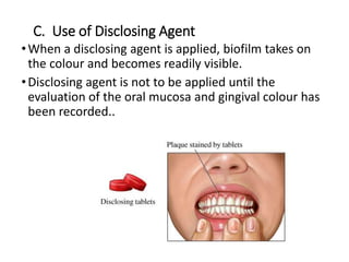 LECT 3 DENTAL PLAQUE DEFINITION AND AETIOLOGY .pptx