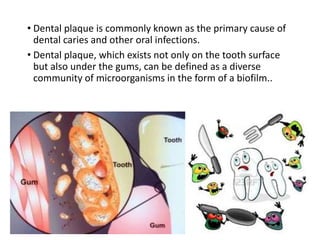 LECT 3 DENTAL PLAQUE DEFINITION AND AETIOLOGY .pptx