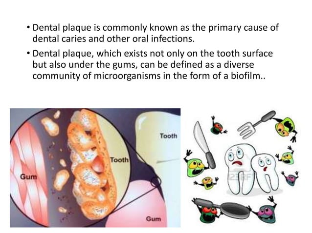 LECT 3 DENTAL PLAQUE DEFINITION AND AETIOLOGY .pptx