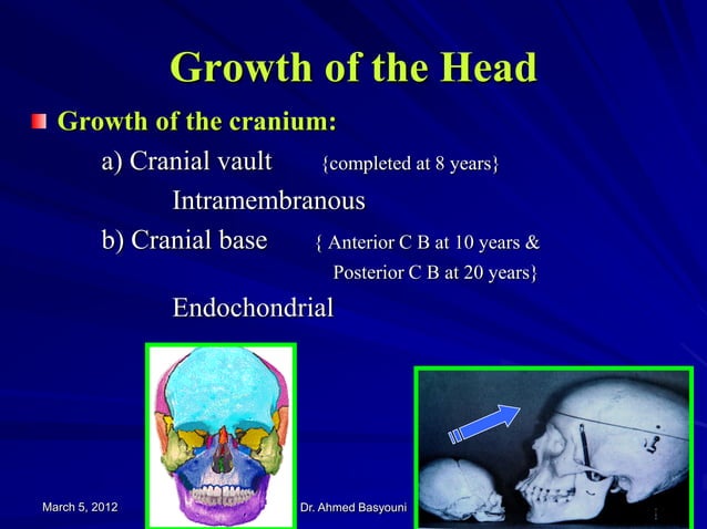 Growth and Development of Craniofacial Complex I | PDF | Bone and Joint ...