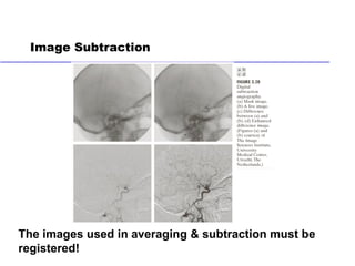 Digital Image Procesing | PDF