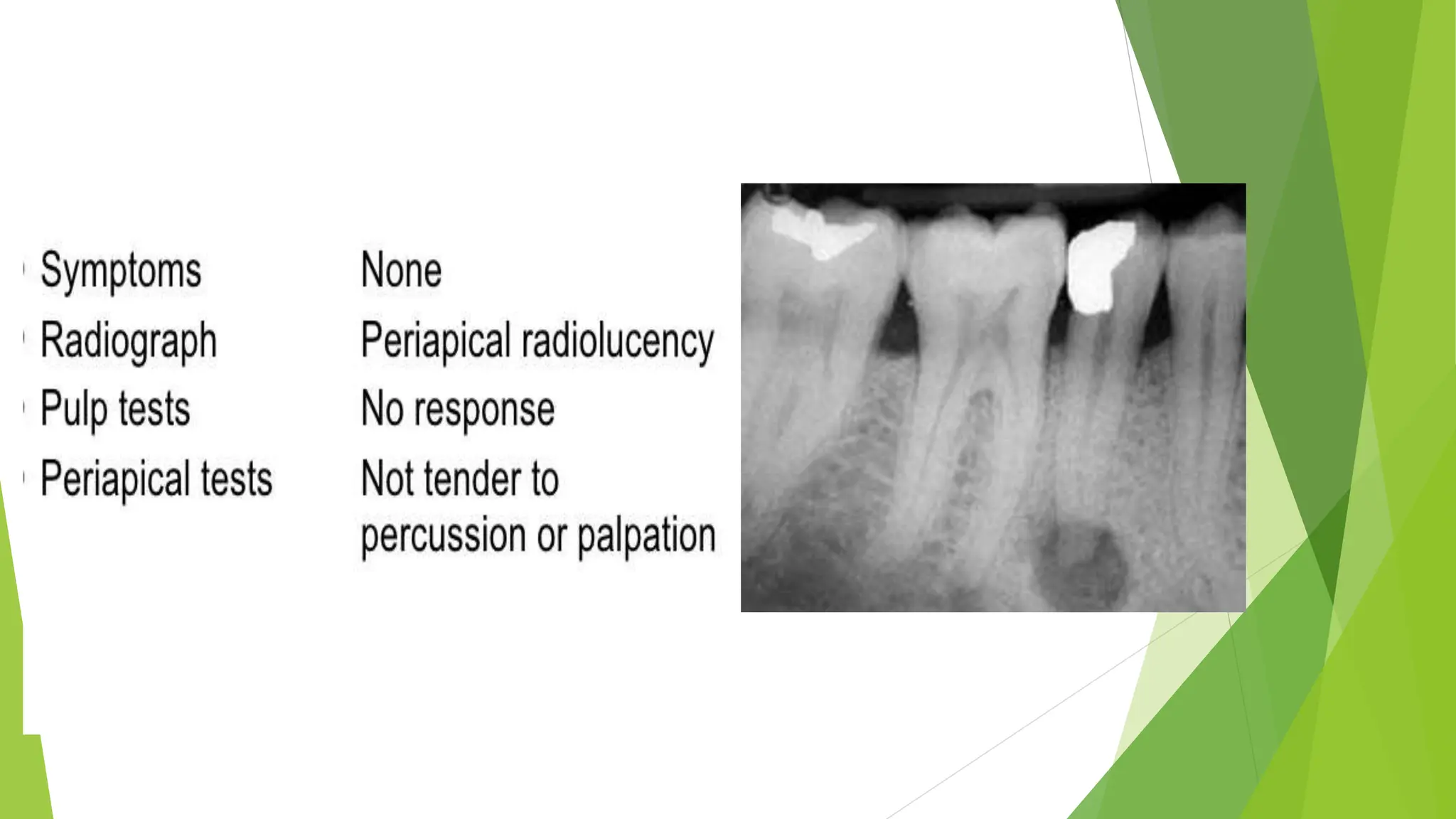 LECT#4 1Pulpal and periradicular pathosis 2.pptx