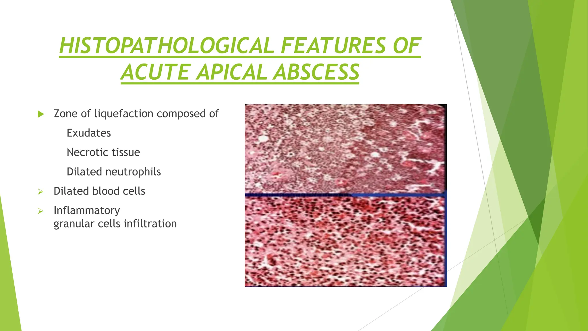 LECT#4 1Pulpal and periradicular pathosis 2.pptx