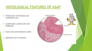 LECT#4 1Pulpal and periradicular pathosis 2.pptx
