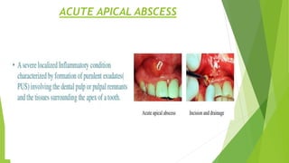 LECT#4 1Pulpal and periradicular pathosis 2.pptx