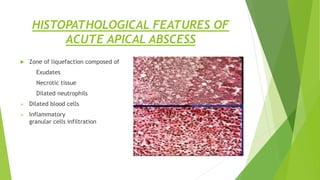 LECT#4 1Pulpal and periradicular pathosis 2.pptx