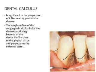 LECT 4 DENTAL CALCULUS INCLUDING FORMATION AND CAUSES.pptx