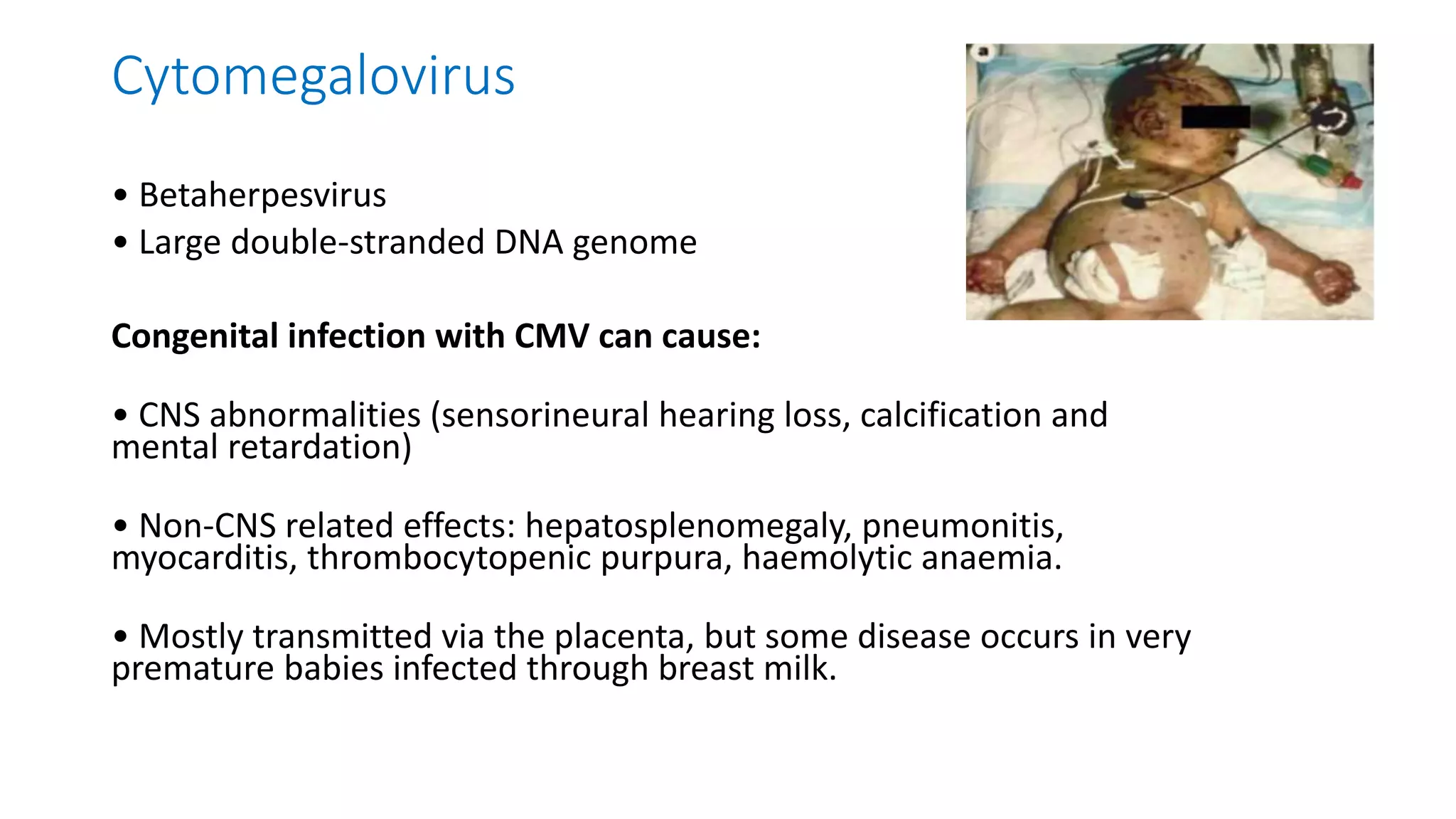 Lect 5 Obstetrics and Perinatal Infections.pptx