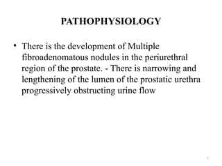 Lect 60. Benign prostrate Hyperplasia.pptx