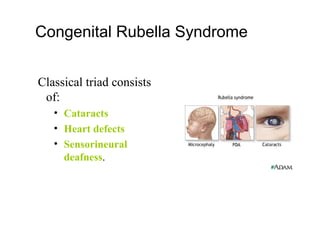 Lect 6 b rubella rmc | PPT