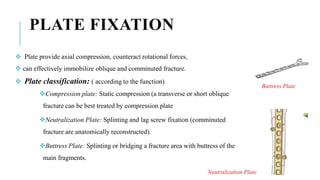 lect_7_-_Internal_fixation_-_I.pptx
