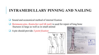 lect_7_-_Internal_fixation_-_I.pptx