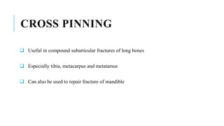 lect_7_-_Internal_fixation_-_I.pptx