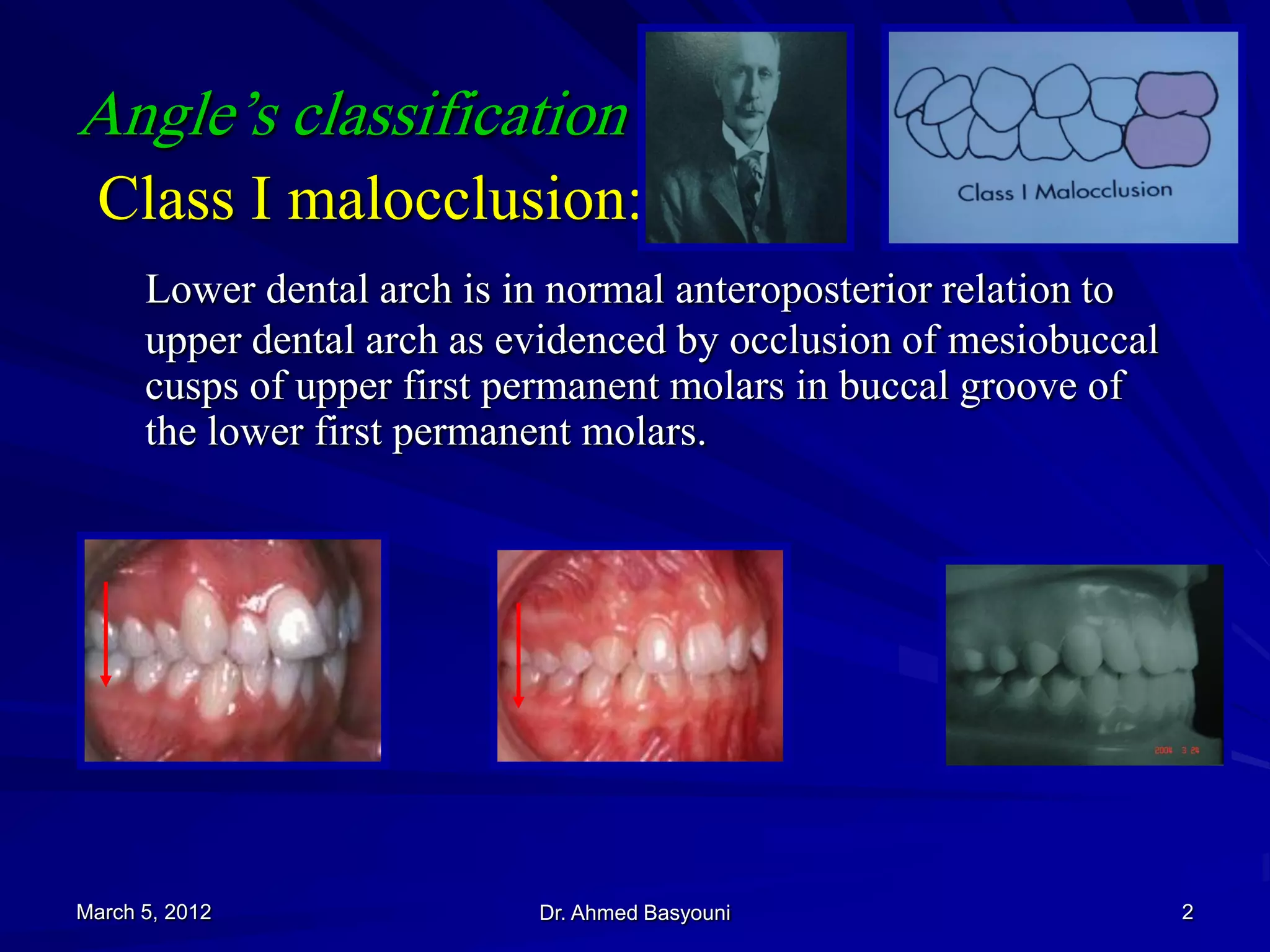 Etiology of Malocclusion I | PDF
