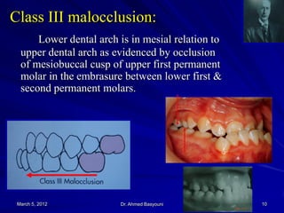 Etiology of Malocclusion I | PDF