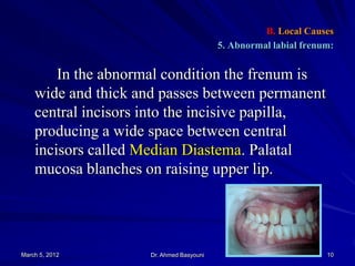 Etiology of Malocclusion II | PPT