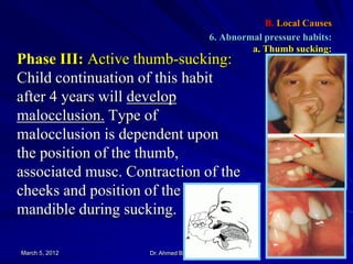 Etiology of Malocclusion II | PDF