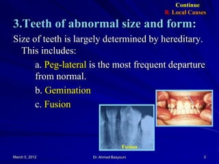 Etiology of Malocclusion II | PPT
