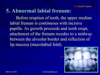 Etiology of Malocclusion II | PDF