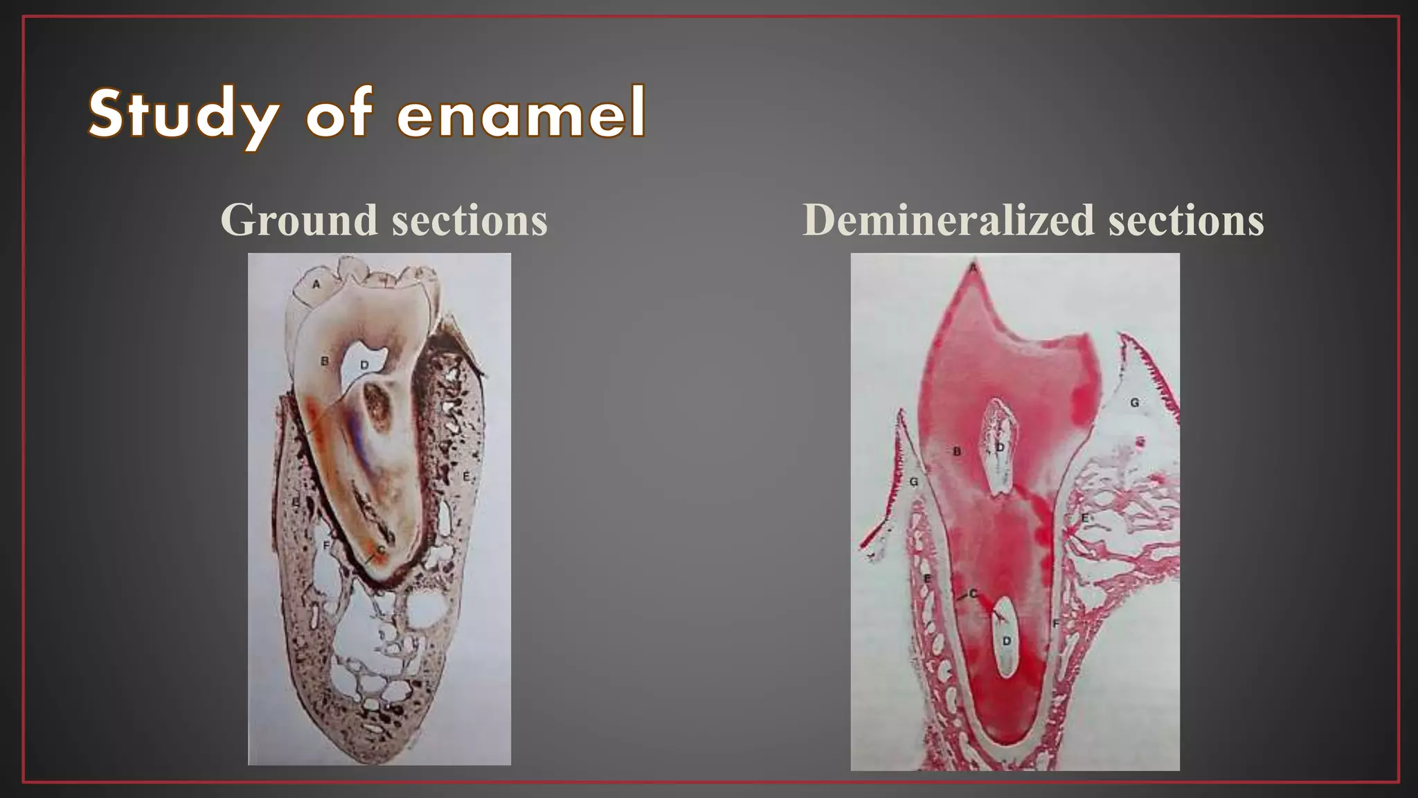 1st BDS Lecture on tooth Enamel | PPTX