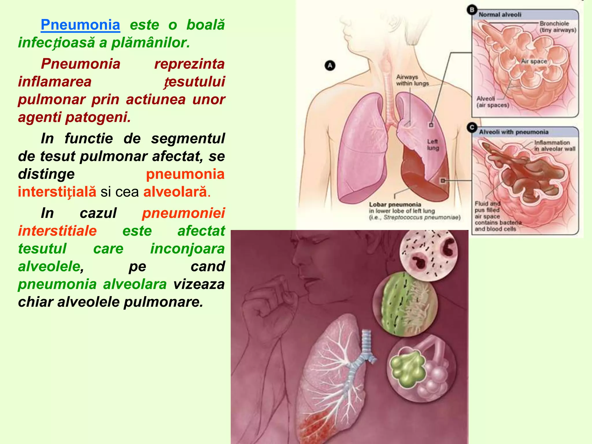 Lectie 27 igiena_sistemului_respirator.. | PPT