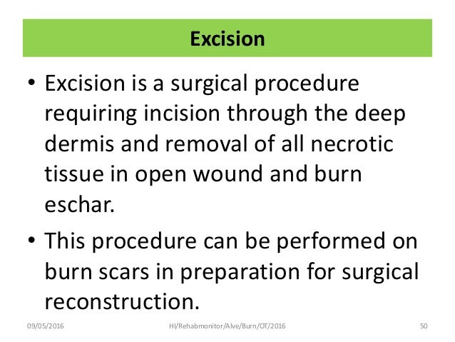 Physical Dysfunction: Burn Rehabilitation